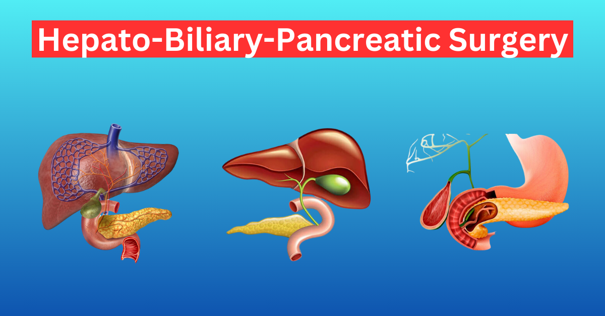 Hepato Pancreato Biliary Cancer